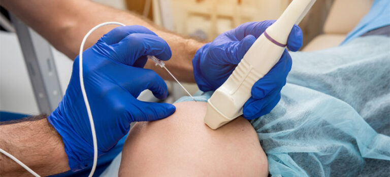 Radiofrequency Nerve Ablation | Innovative Pain Care Center